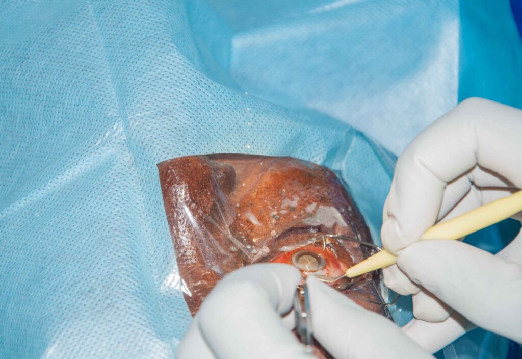 Home - Eldo Eye Center